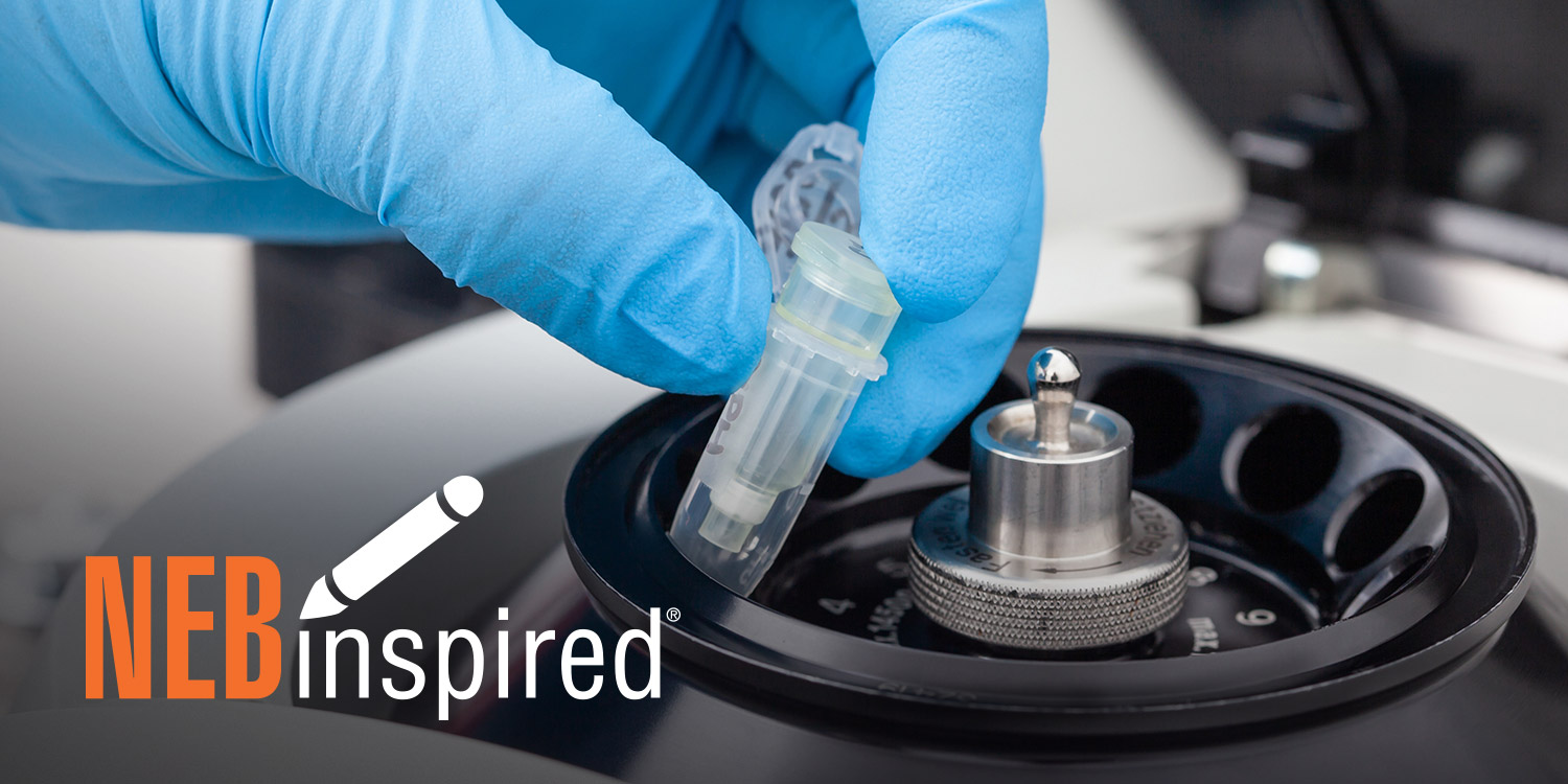 Essential Tips for PCR & DNA Cleanup: Maximize Your DNA Purity and ...