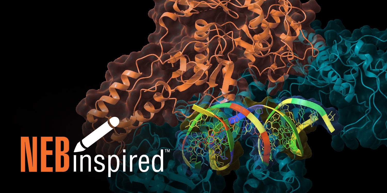 What Is The Difference Between Intron Encoded And Retroviral Reverse Transcriptases Neb