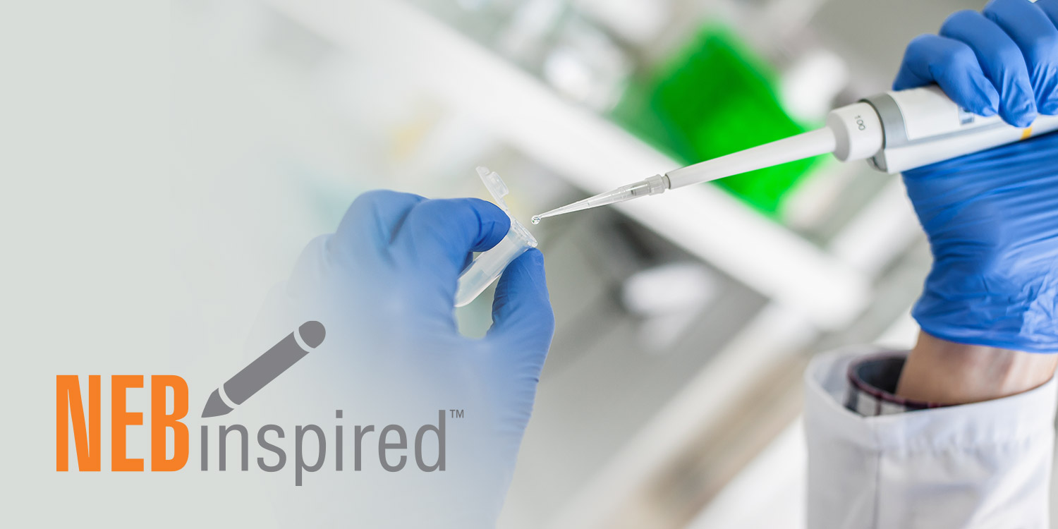 SARS-CoV-2 RT-qPCR workflow research to advance clinical testing | NEB