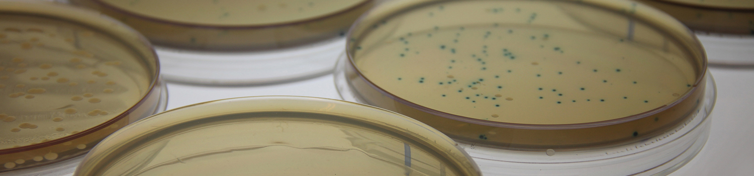 DNA Assembly, Cloning and Mutagenesis Kits | NEB