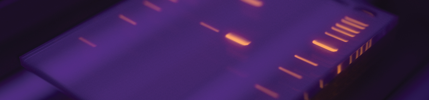 Quick-Load Purple DNA Ladders | NEB