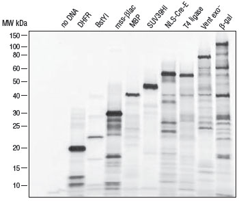 PURExpress® In Vitro Protein Synthesis Kit | NEB