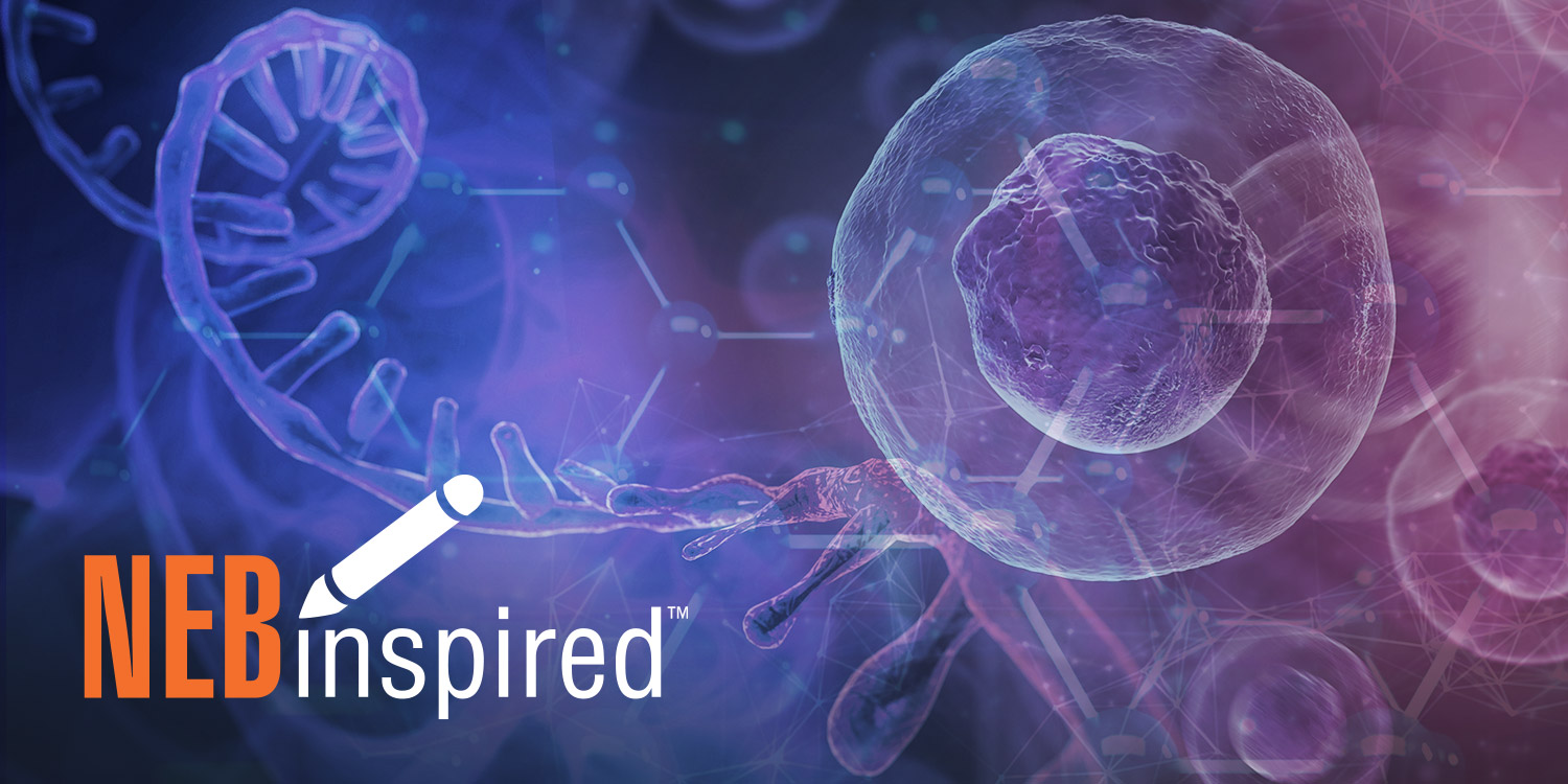 Guiding CRISPR/Cas13 Activity Using Chemically Modified Guides | NEB