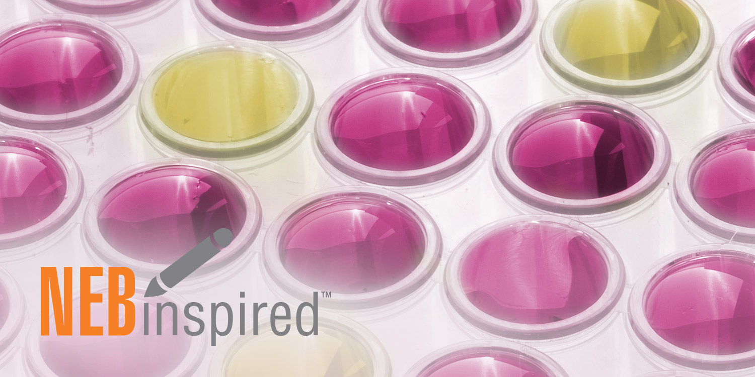 Getting started with loop-mediated isothermal amplification (LAMP) | NEB