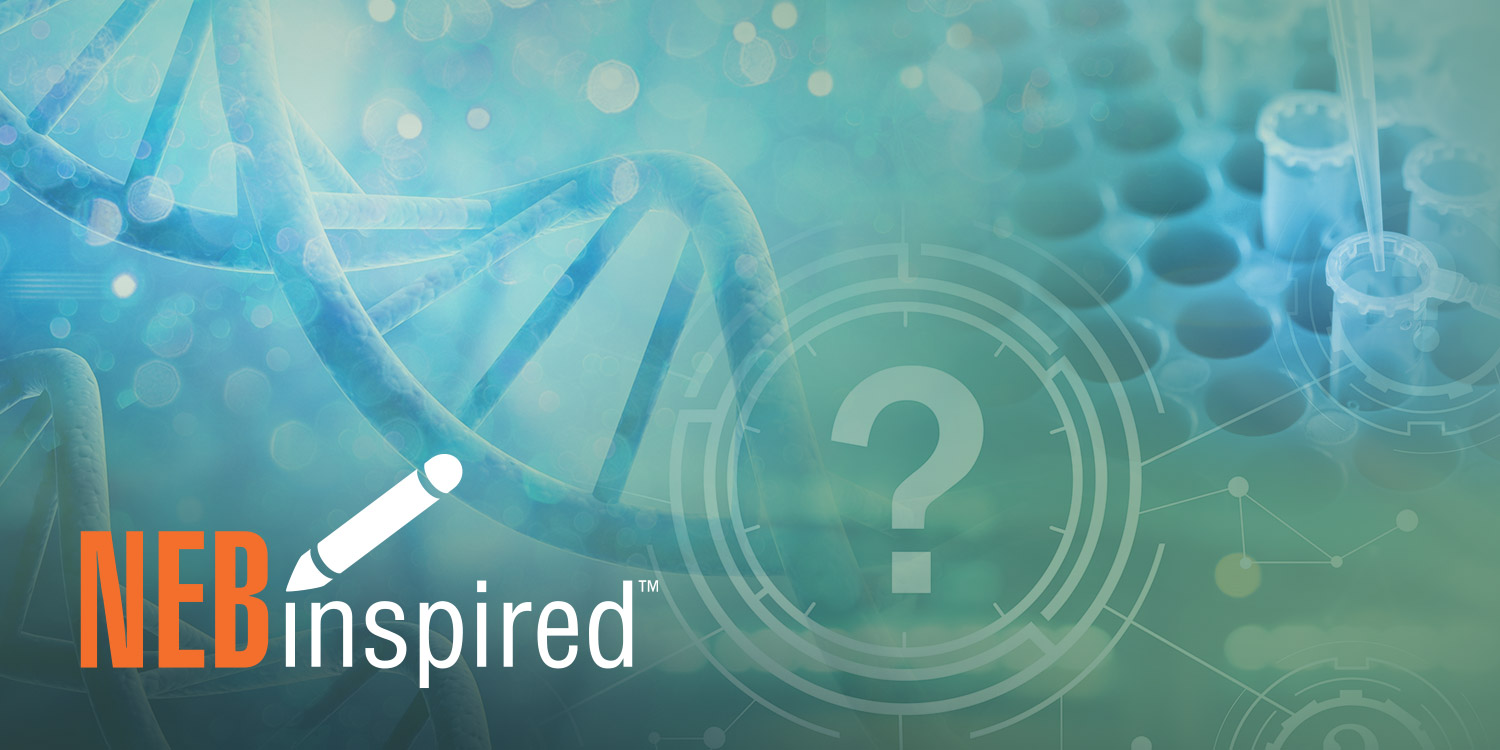 Which DNA Ligase is the best choice for DNA Assembly? | NEB
