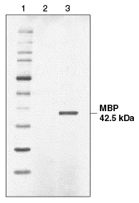 K. lactis Protein Expression Kit | NEB