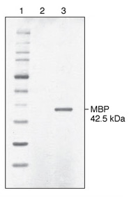 Protein Expression in Yeast | NEB
