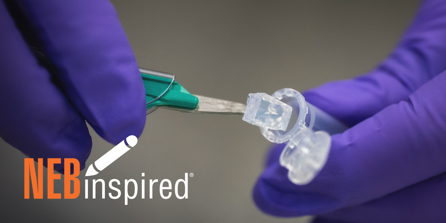 Essential Tips for Successful DNA Gel Extraction | NEB