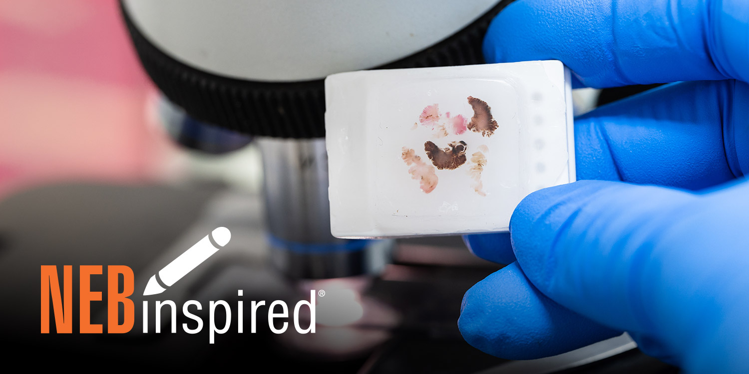 Overcoming Challenges In Ffpe Dna Library Prep Neb