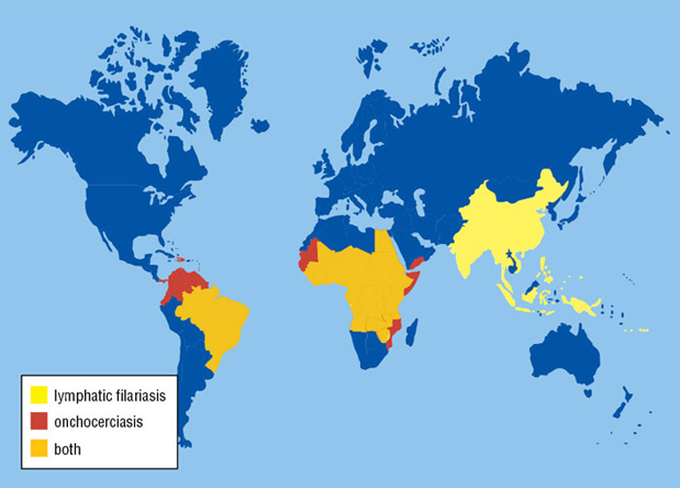 elephantiasis countries